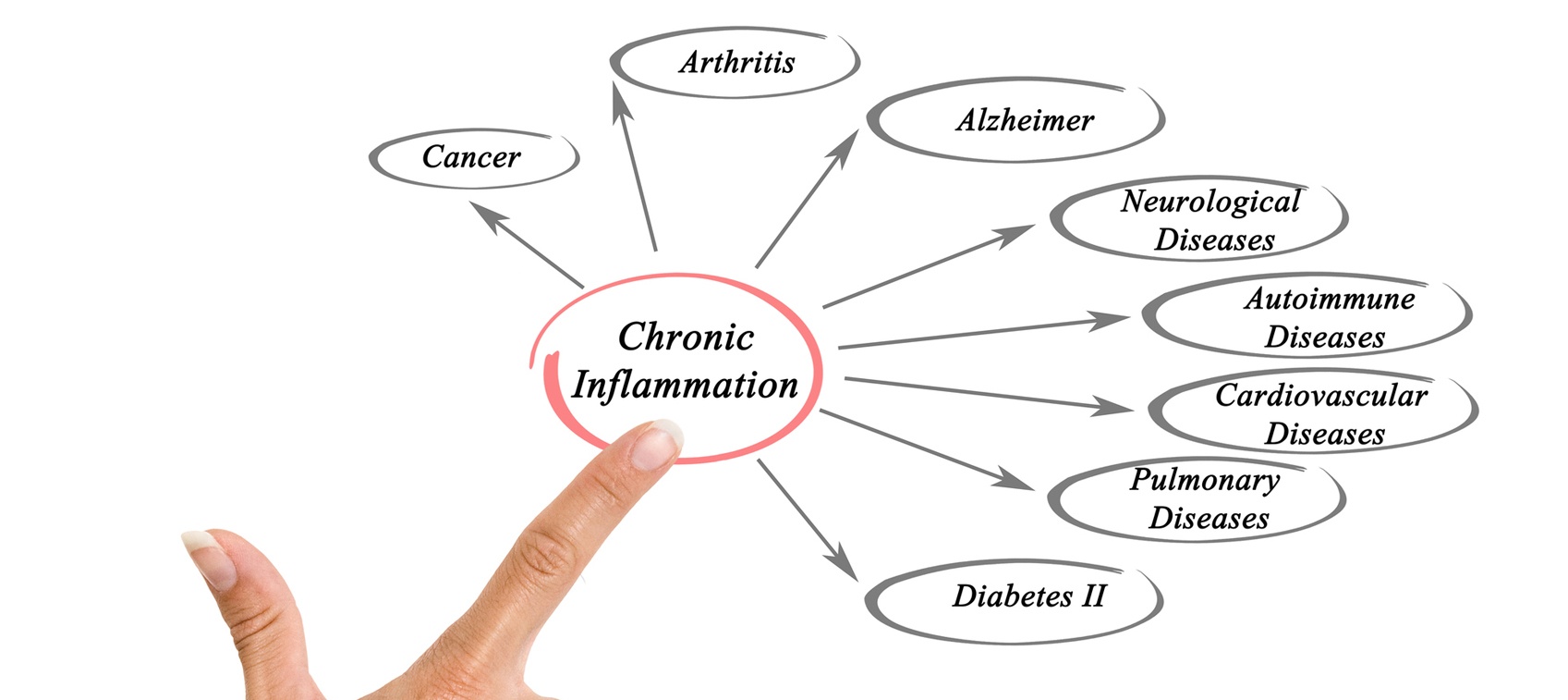 Five Ways to Decrease Chronic Inflammation Flare-Ups - Palmetto ChiroMed
